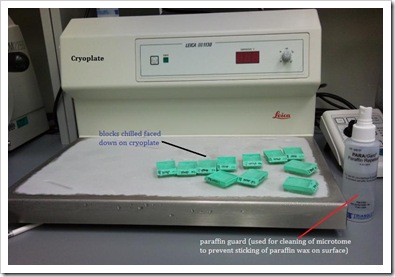 medtechrush.blogspot: Histology - Microtomy